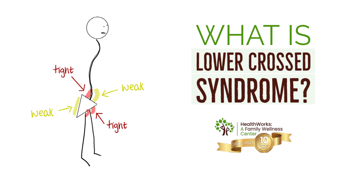 What Is Lower Crossed Syndrome?